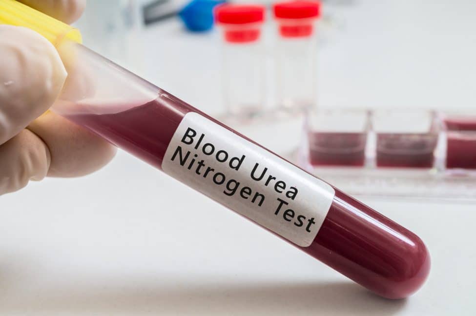 Determination Of Urea In The Blood Dr Sunil Prakash